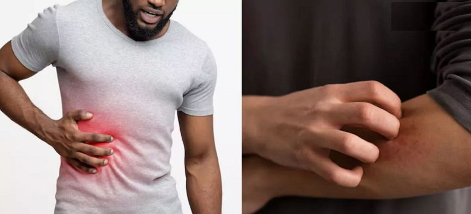 The body screams out these 5 symptoms of liver damage, identify them ...