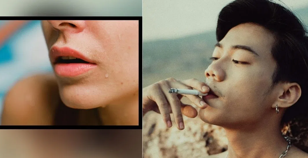 Does Smoking Really Darken Your Lips? Experts Reveal the Truth Behind ...