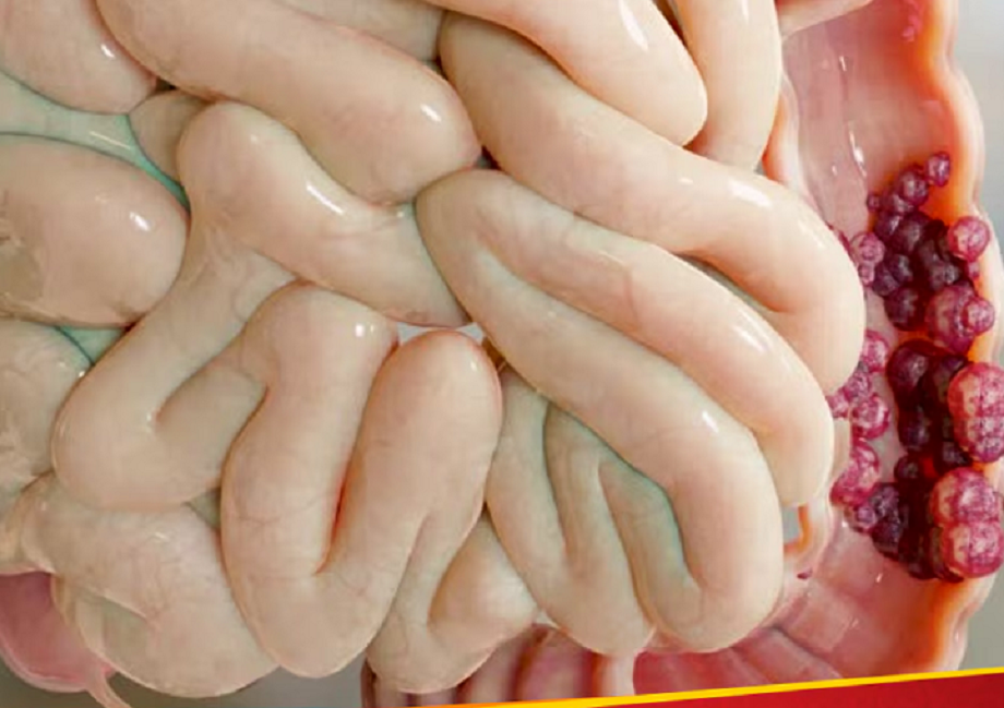 Food particles in stool, do not ignore more than 2 times, it may be a ...