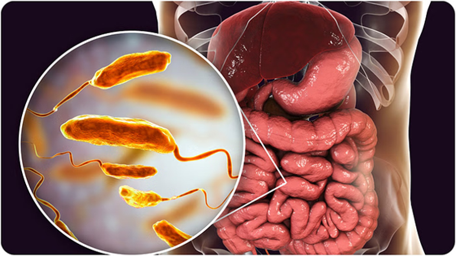 Health Tips: What is 'gut microbiome'? Know the deep connection of ...