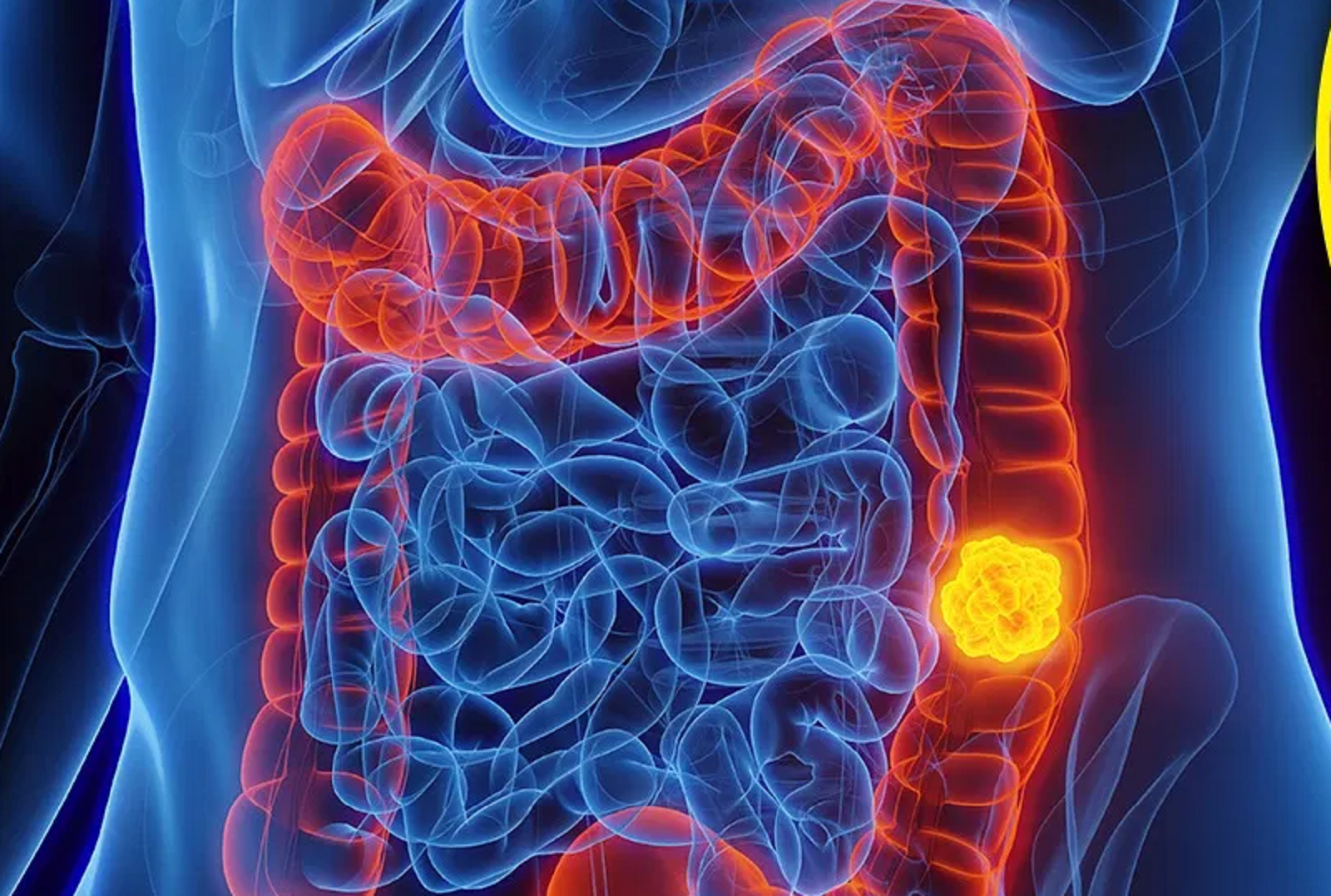 Hidden Antibiotic in Eggs Raises Cancer Concerns: What Are Nitrofurans ...